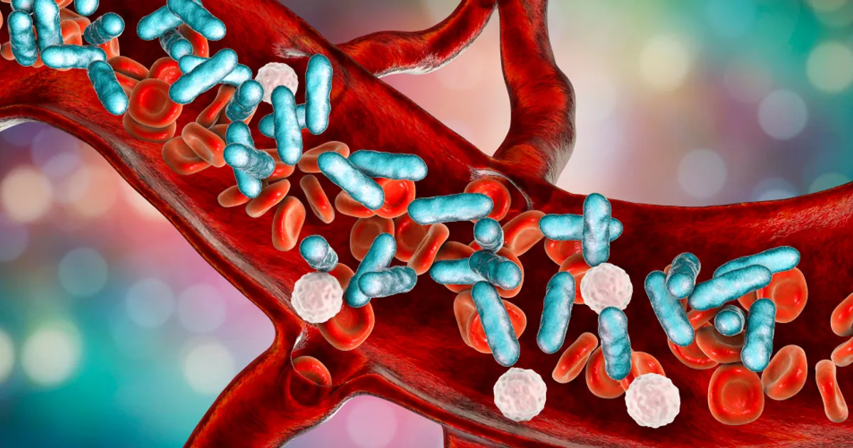 Important Facts About Sepsis - Page 9 of 9 - ActiveBeat - Your Daily ...